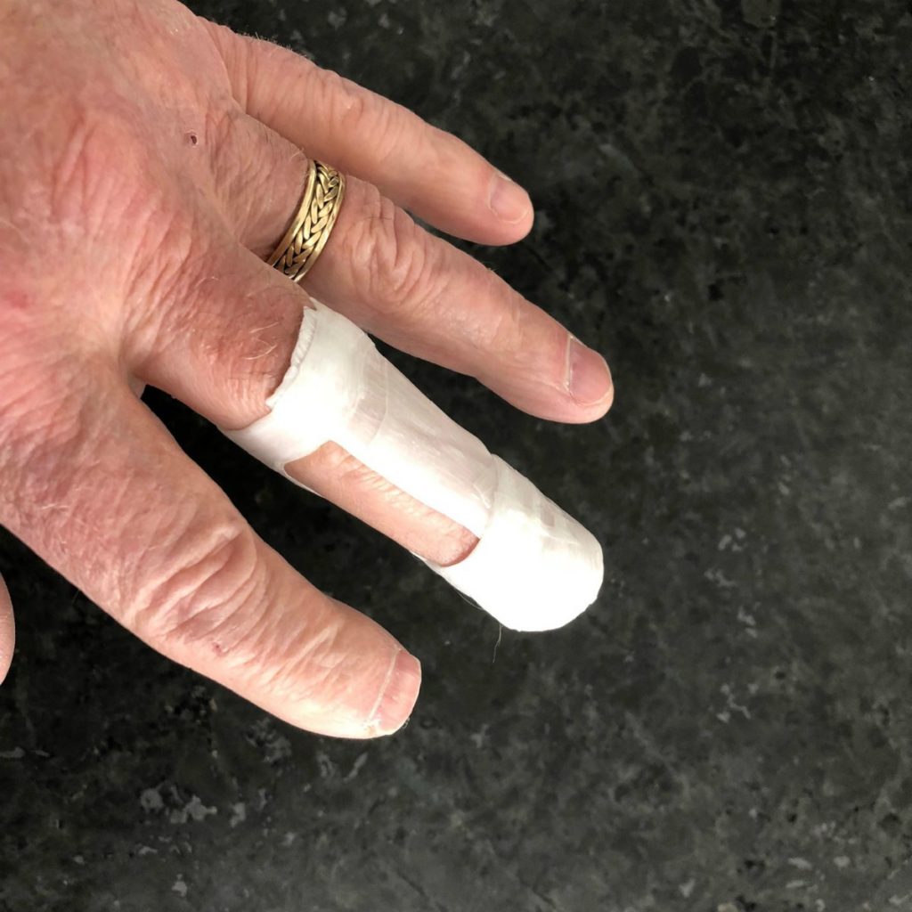 Forj Thermoplastic Ribbon for Emergency Repairs - GetdatGadget